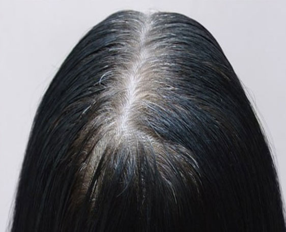 Before & After – Bio Aesthetics